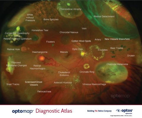 Optos | Prince William Eye Associates - Full Service Eye Care in Prince ...